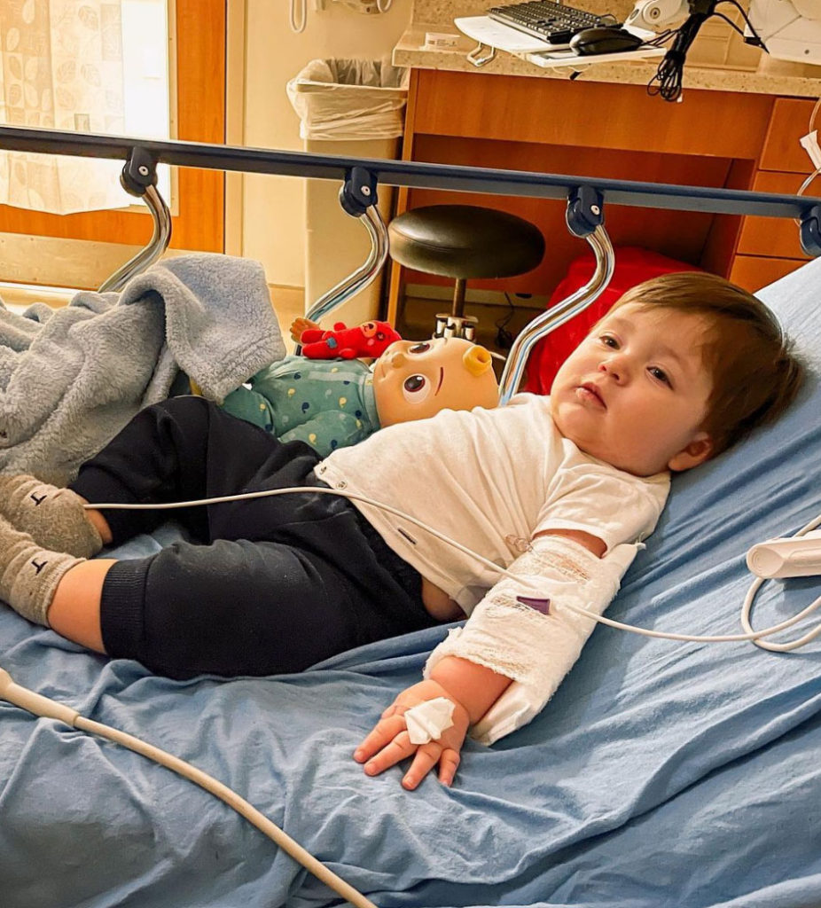 Measles Rash And High Fever After MMR Vaccine